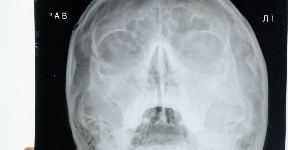 What does a full body scan detect? What does a full body scan detect?